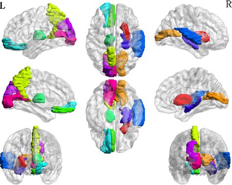 Figure 1 From Cross Modal Transformer Gan Brain Structural Functional