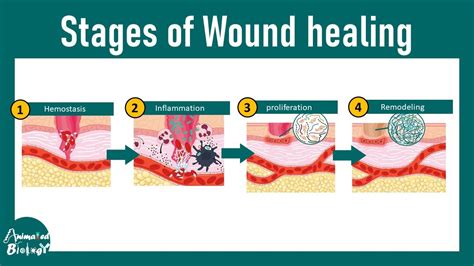 Wound Healing Stages Steps Of Wound Healing Wound Healing And