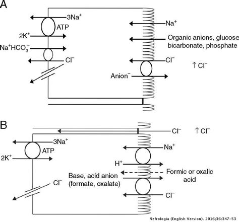 Hyperchloremia Why And How Nefrología English Edition