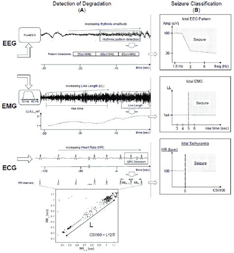Multimodal Seizure Detection System With High Sensitivity Of A5 Download Scientific Diagram