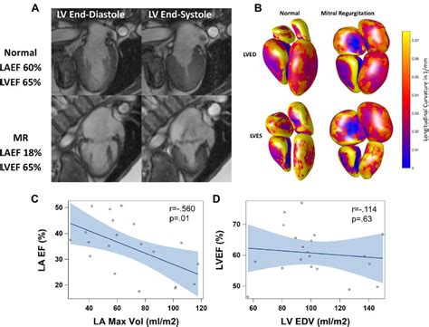 Cardiac Magnetic Resonance And 3d Images Download Scientific Diagram