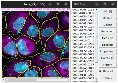 Cellposestardist Segmentation — Pyimagej Documentation
