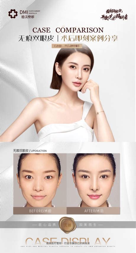 医美案例双眼皮系列海报psd广告设计素材海报模板免费下载 享设计