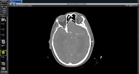 Read Annotations On Pixeldata Field · Issue 1652 · Pydicompydicom · Github