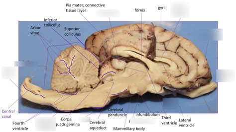 Sheep Brain Diagram Quizlet