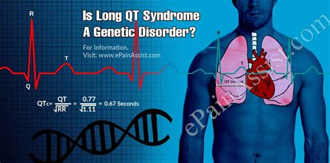 Is Long Qt Syndrome A Genetic Disorder