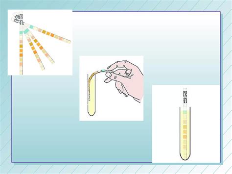 Lp 16 Urinary System And Urinalysis 2008 Ppt