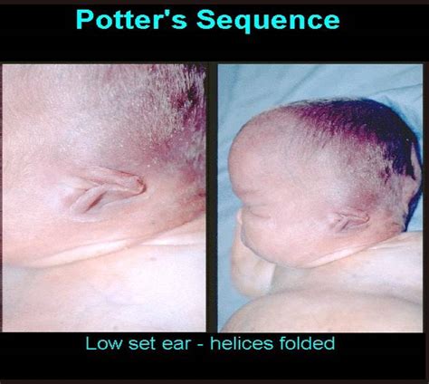 Potters Sequence At Numbers Mcleod Blog