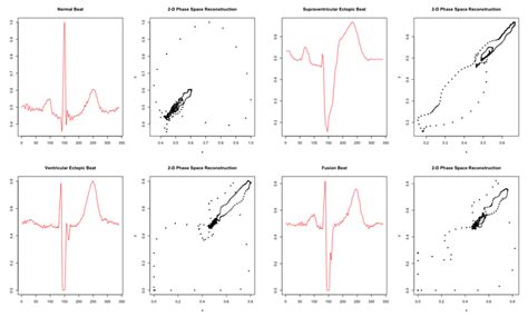 Time Delay Embedding For The Arrhythmia Types Download Scientific
