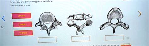 Solved Identify The Different Types Of Vertebrae Note Size Is Not To Scale Cervical Lumbar