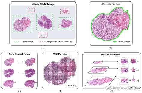 针对超大规模病理图像分析！华中科技大学提出医学图像分割模型，提高干燥综合征诊断准确性 智源社区
