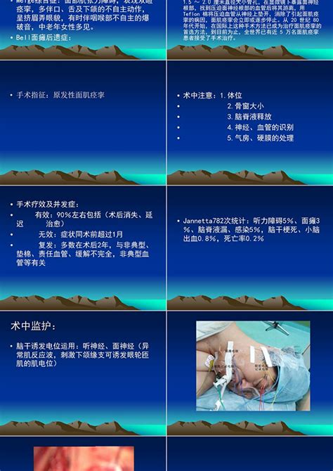 Ppt