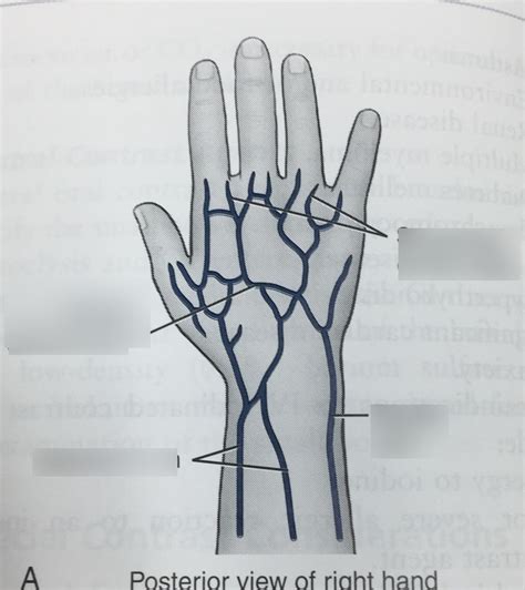 CT PT CARE Diagram Quizlet
