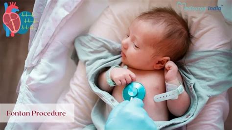 Fontan Procedure Cost In India Fontan Procedure Fontan Surgery