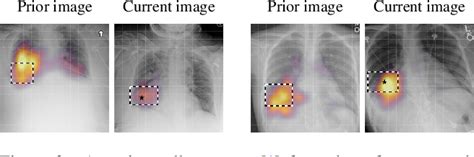 Figure 1 From Learning To Exploit Temporal Structure For Biomedical