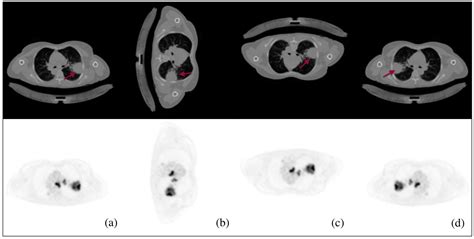 Diagnostics Free Full Text Hyper Denselungseg Multimodal Fusion