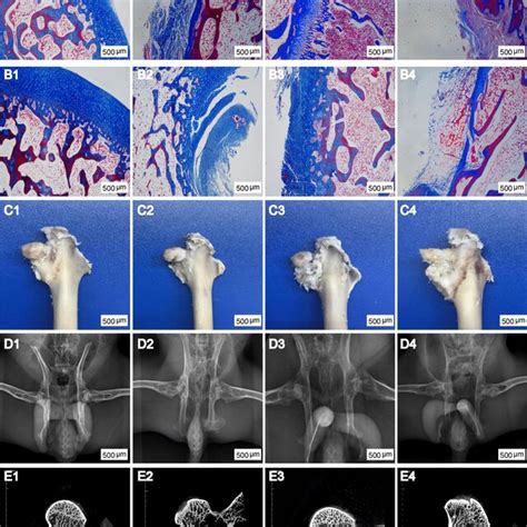Overexpression Of Runx2 Promotes Osteonecrosis Repair A1a4 And
