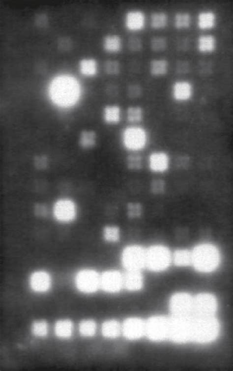 Representative Example Of A Gene Array Expression Profile Of Representative Example Of A Gene Array Expression Profile Of