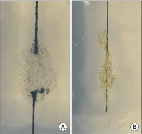Pdf Tissue Mimicking Phantom Useful In Simulating Laser Light Tissue
