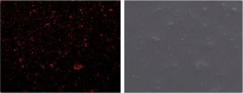 Mapping Micrograph Left And Corresponding Sem Image Right Of