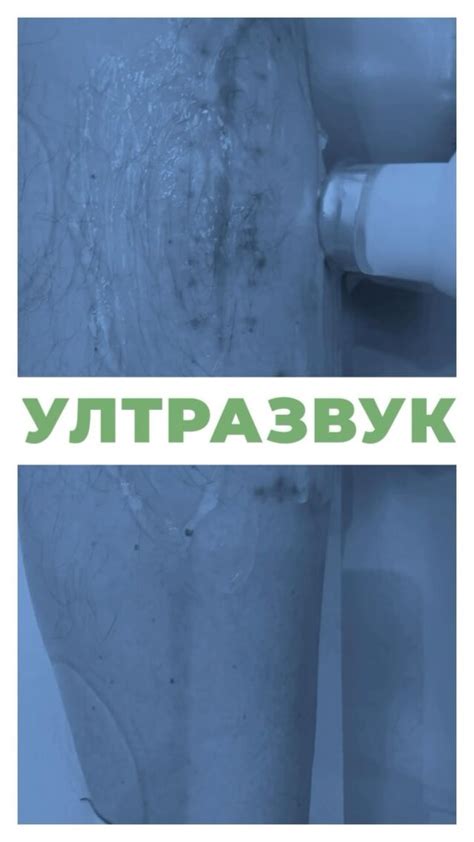 Заболявания Okto