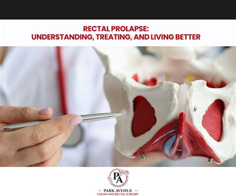 Rectal Prolapse Symptoms And Prolapsed Bowel Treatment