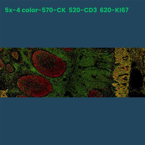 4 Color Multiplex Fluorescence Detection Kit