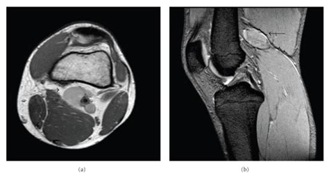 Magnetic Resonance Mri Se T1 Dual Axial A Se T2 Ffe Sagittal B Download Scientific