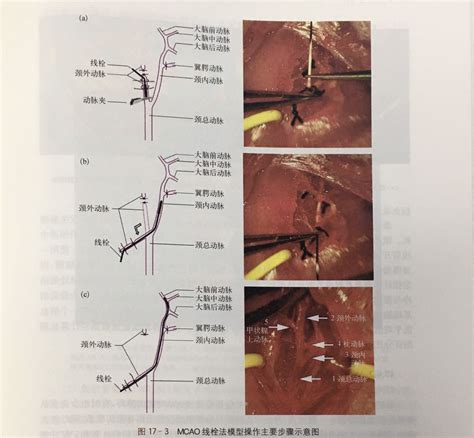 技术干货 Mcao造模方法及如何提高成功率 公司新闻 深圳市瑞沃德生命科技股份有限公司