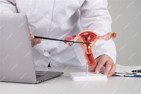 그의 바탕 화면에 여성 생식 기관의 의사 산부인과 의사 가리키는 모델 프리미엄 사진