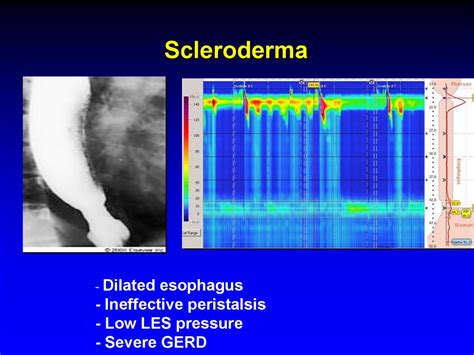 Esophagus Esophageal Structure презентация онлайн
