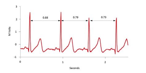 Heart Rate Variability Hrv