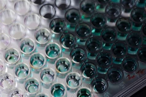 실험실 테스트를 위한 96개의 우물 마이크로플레이트를 가진 물고기 혈액 조성의 연구 마이크로플레이트에 대한 스톡 사진 및 기타