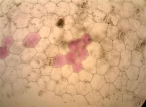 Solved Ignore Cells Devoid Of Any Color Plasmolysis Is The