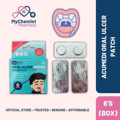 Acumedi Oral Ulcer Patch 6s Box Plaster Tampal Ulser Mulut Sesuai
