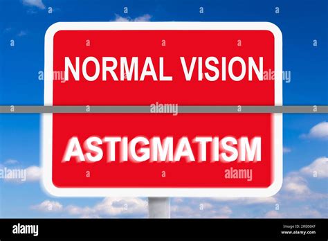 Example Of Normal Vision Versus Eyesight With Astigmatism An Optical Aberration Of The Cornea