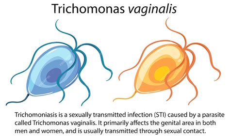 Free Vector Trichomonas Vaginalis With Explanation