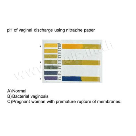 กระดาษลิตมัสวัดค่า Ph ทางการแพทย์ Nitrazine Yellow Paper