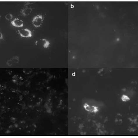 Transfection Of A Plasmid Expressing A Fluorescent Protein That Download Scientific Diagram