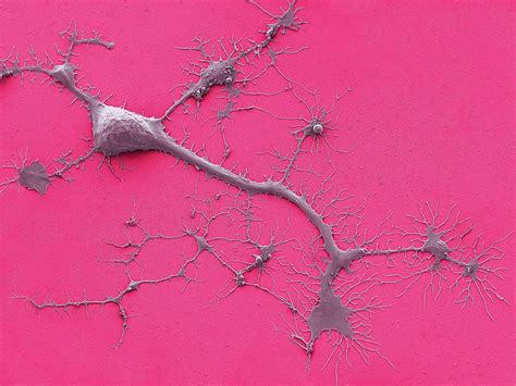 Stem Cell Derived Neuron Photograph By Thomas Deerinck Ncmir Science Photo Library