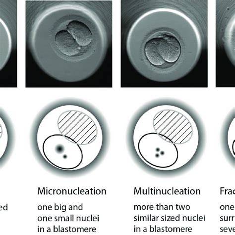 Illustration Of The Different Nucleation Error Phenotypes Nep In Download Scientific Diagram