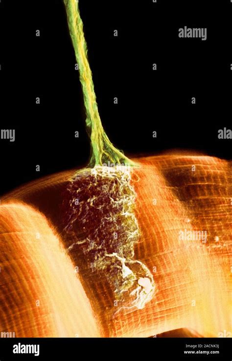 Synapse Coloured Scanning Electron Micrograph Sem Of A Neuromuscular Junction Showing A Motor