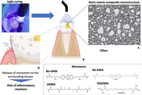 Types Of Composite Resin At Joel Herrera Blog