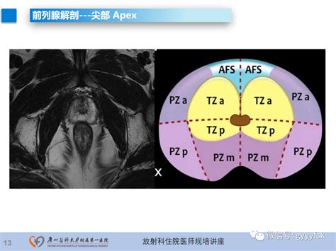 前列腺的解剖及mr表现