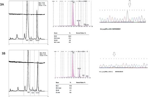 Figure 1 From Comparison Of Capillary Zone Electrophoresis With High Pressure Liquid