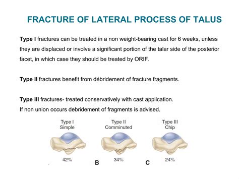 Talus Fracture Treatment Algorithm Pptx Death Injury Or Military