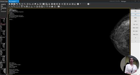 Shabnam Taleghani On Linkedin Effective Mammogram Hanging Protocols Are Essential For Ensuring