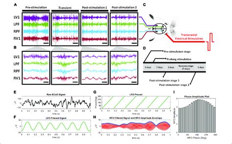 Ecog Experimental Design And Steps Taken To Compute Cross Frequency