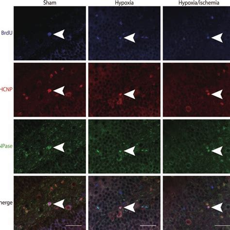 Expression Levels Of Hcnp Precursor Determine Phenotypic Expression Of Download Scientific