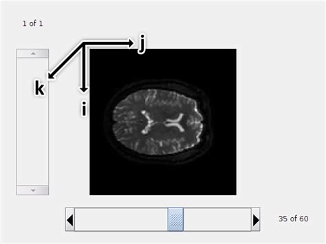 working with nifti 1 files in matlab